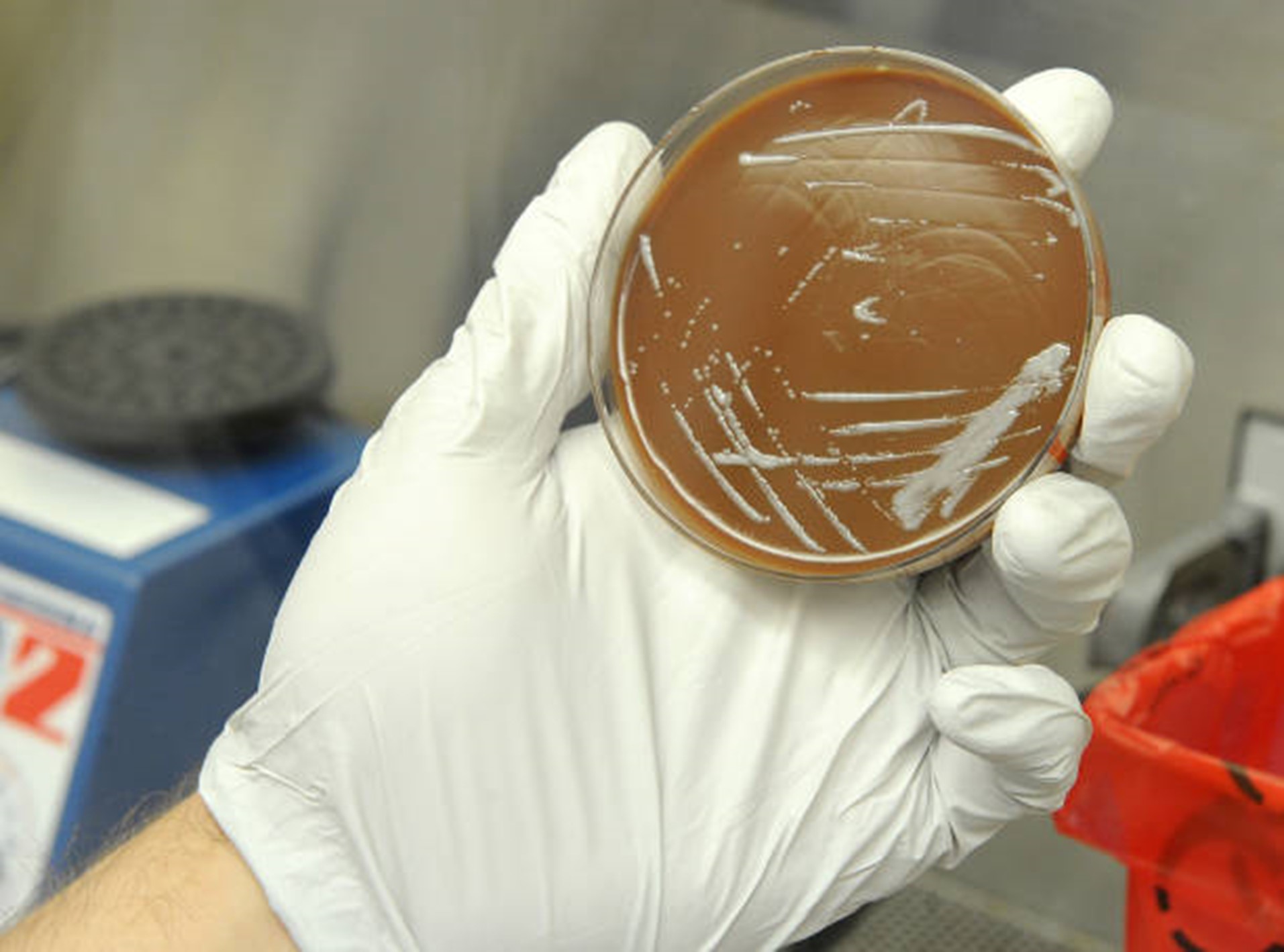 Identifiable Gram Positives on Mannitol Salt Agar in California